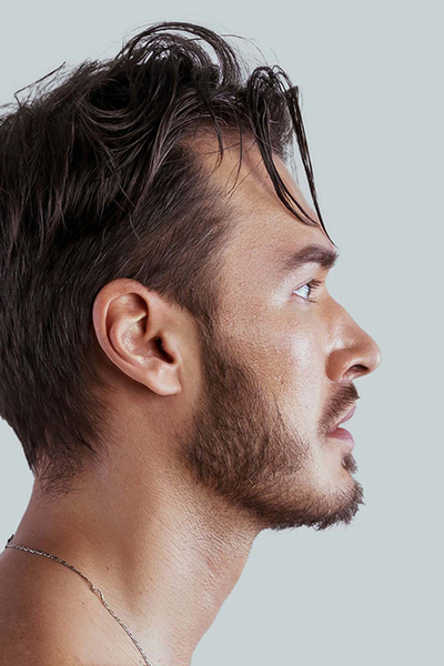 Facial Masculinization Surgery Los Angeles - FMS LA