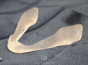 Facial Masculinization Surgery Photo Gallery - Paul Mittermiller, MD